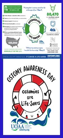 Ostomy Awareness Day 2022! – Journal of a Warrior's Journey